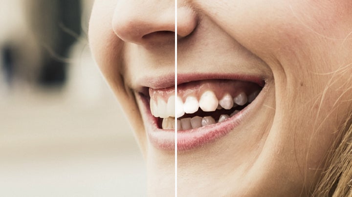 Touch Up | BeFunky: Image Retouching & Face Editor