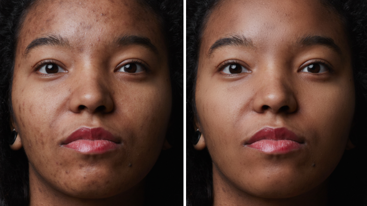 Touch Up: BeFunky - Image Retouching & Face Editor