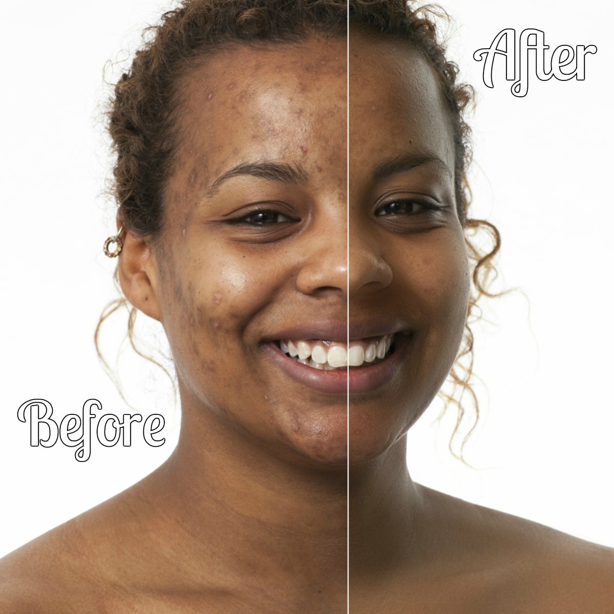 Naturally Perfect Skin