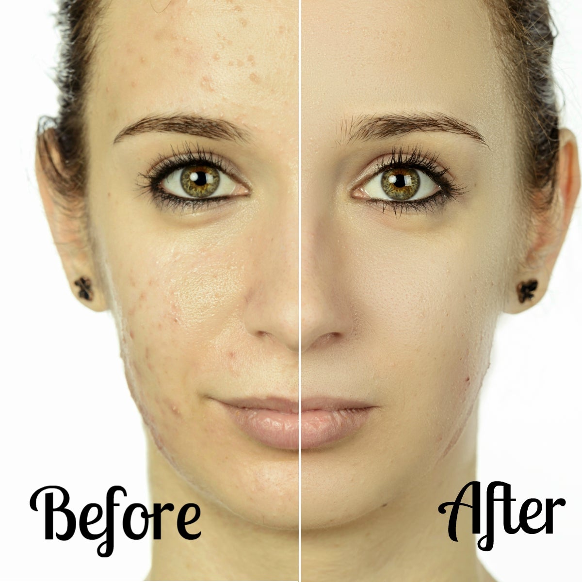 Naturally Perfect Skin