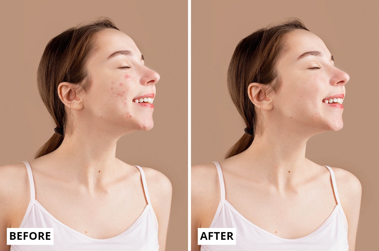 How to Retouch Portrait Photos and Remove Blemishes | Learn BeFunky