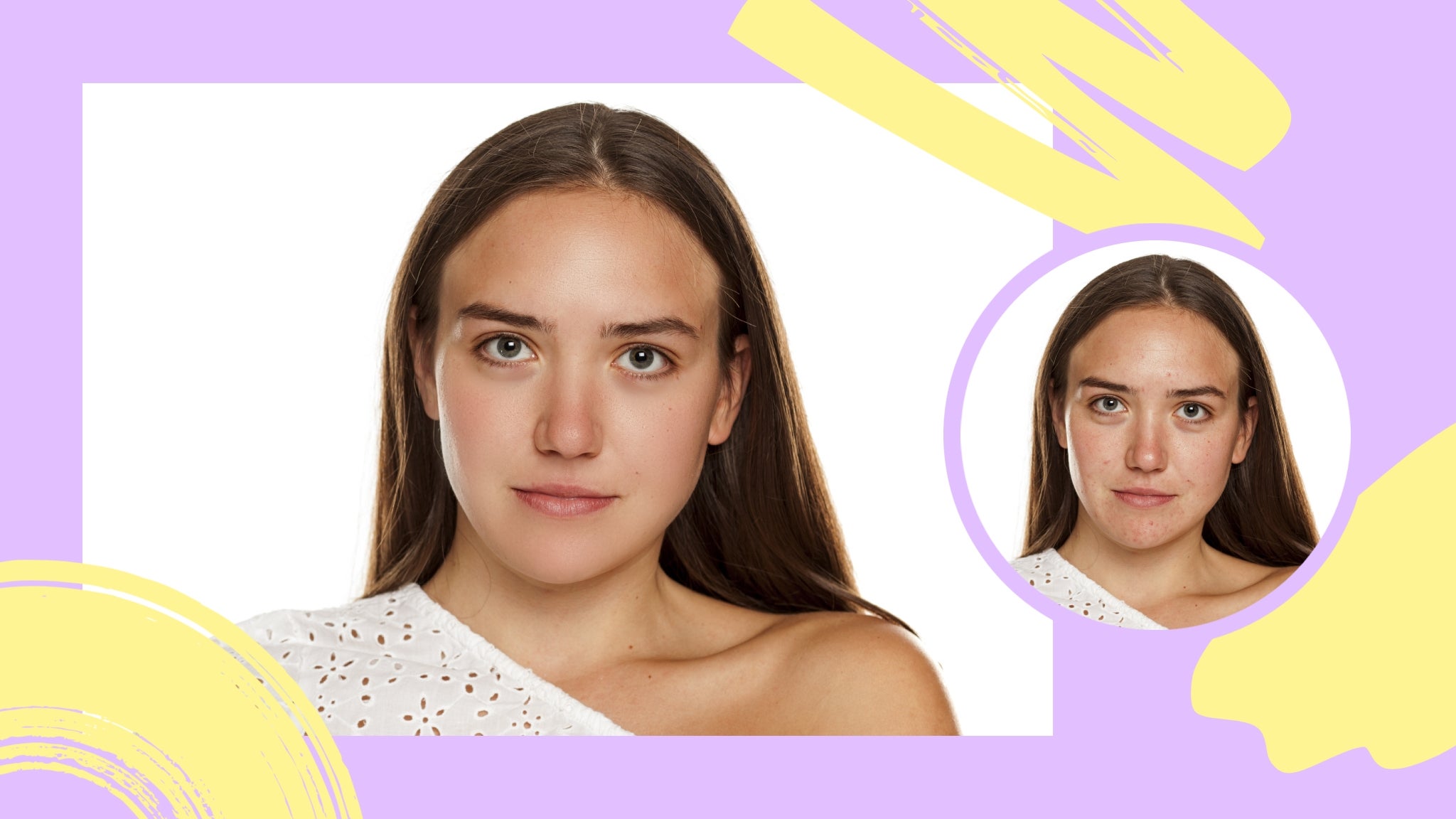 How to Remove Blemishes from Photos for Free | Learn BeFunky